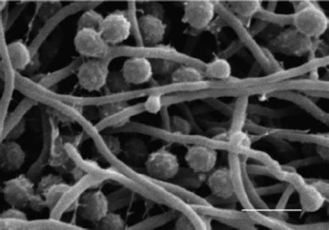 Scanning Electron Micrograph Of Substrate Mycelium Of Download