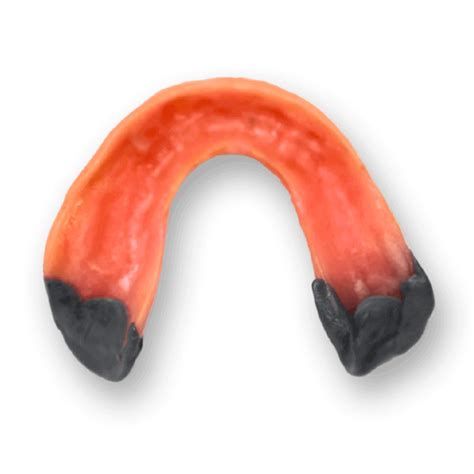 Avadent Reference Denture Accurate And Efficient Fit