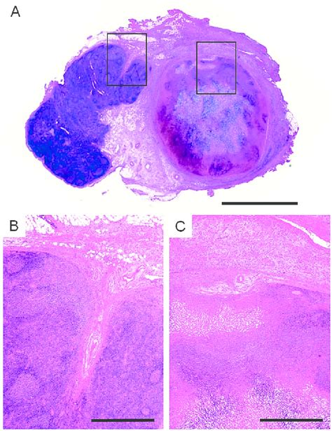 Histological Findings Of Viable And Infarcted Areas 1a Whole Mount