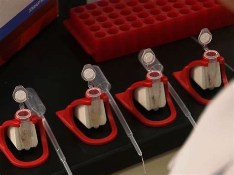 Video Conversion Of A Capture Elisa To A Luminex Xmap Assay Using A