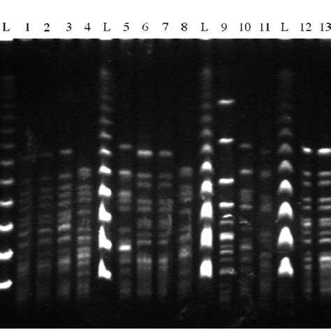 Pfge Of Smai Macrorestriction Fragments Of E Faecium Clinical