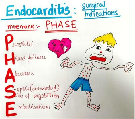 Endocarditis Surgical Indications Phase Mnemonic For Easy Recall