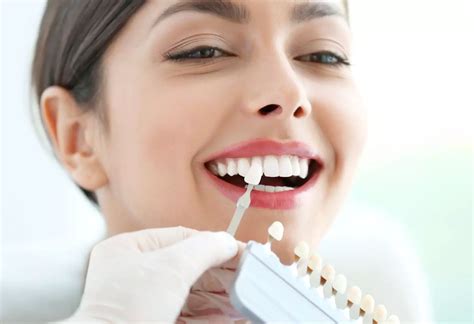 O Que São Facetas E Como Elas Podem Transformar O Seu Sorriso