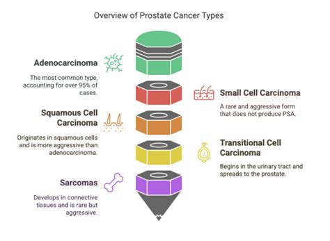 Types Of Prostate Cancer The Focal Therapy Clinic