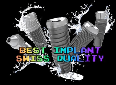 Best Dental Implants S Find And Share On Giphy