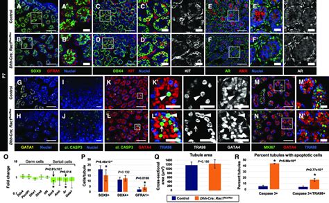 Sertoli Rac1 Function Is Largely Dispensable For Postnatal Testicular Download Scientific