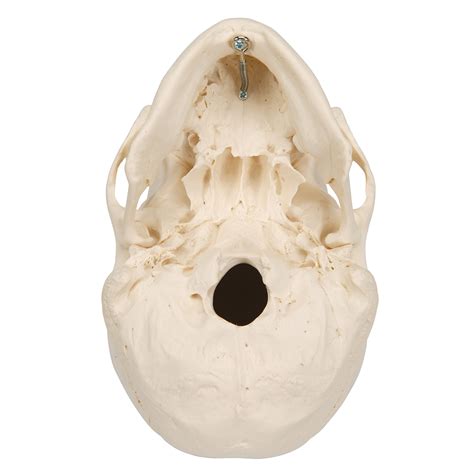 Microcephalic Human Skull Model Sem Trainers