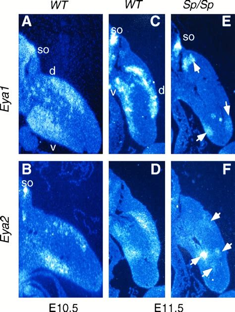 Mouse Eya Genes Are Expressed During Limb Tendon Development And Encode
