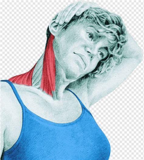 Sternocleidomastoid Stretches