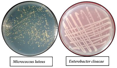 Enterobacter Cloacae Emb