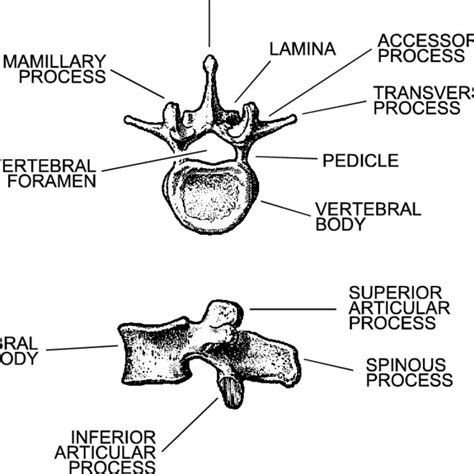 6 Types Of Vertebral Fracture Lateral View A Normal Vertebra