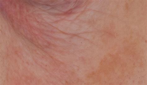 Female 055 Albedo Map