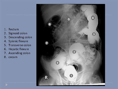 Radiology Of The Abdomen Radiological Modalities 1 2