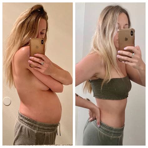 Bloated Stomach