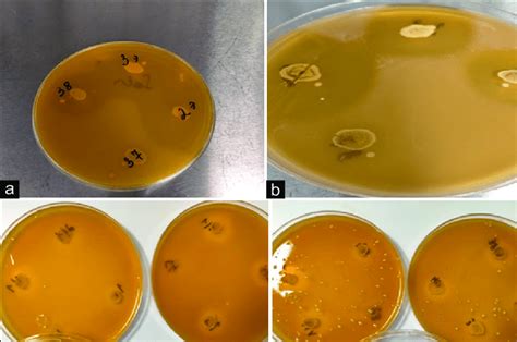 Inhibitory Effect Of Isolated Lactobacillus Isolates To The Following Download Scientific