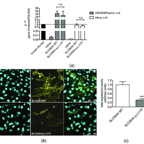 Colocalization Of Human Wild Type Pendrin And Pendrin Variant P L117f Download Scientific