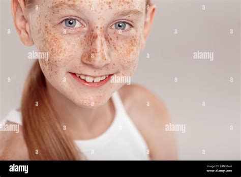 Inclusive Beauty Girl With Freckles Standing Isolated On Grey Smiling