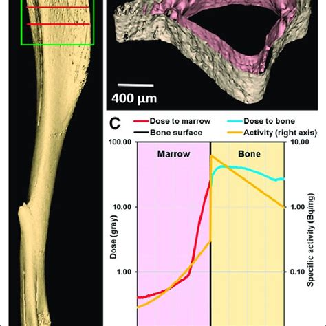 A Three Dimensional Model Of Mouse Tibia Reconstructed From