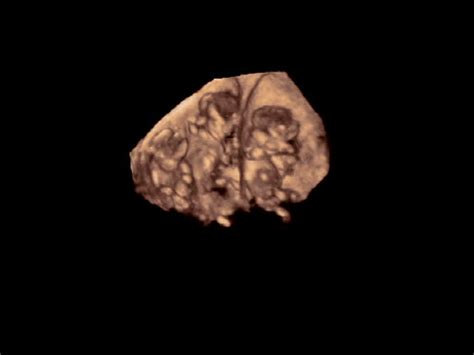 103 Identical Triplets Stock Videos Footage And 4k Video Clips Getty