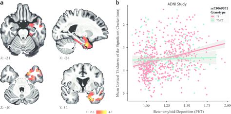 A Results For Whole Brain Voxel Based Analysis Of Download