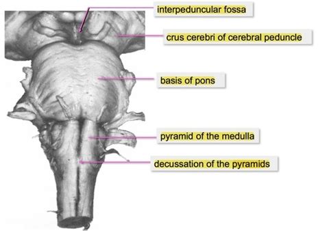 Lab Exam 3 Exercise 17 Brain Structures On Models Medulla Oblongata