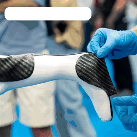 International Society For Prosthetics And Orthotics On Linkedin