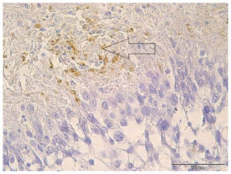 Oncology Letters