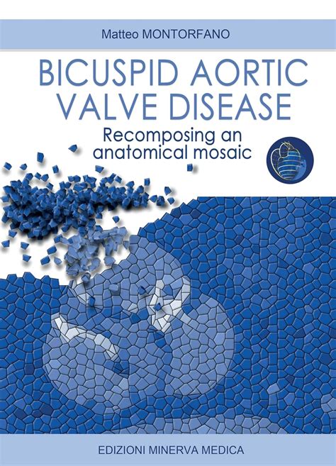 Bicuspid Aortic Valve Disease Recomposing An Anatomical Mosaic M Montorfano 9788855322294