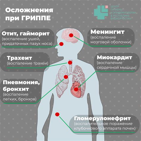 Грипп и его осложнения