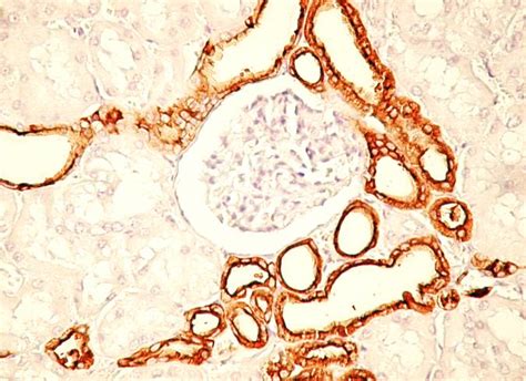 A Internal Positive Control For Epithelial Membrane Antigen Distal