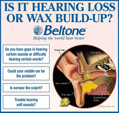 Ear Wax Hearing Loss And Memory Loss At Mason Duckworth Blog