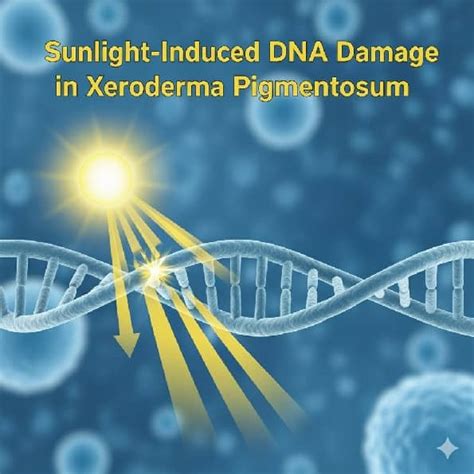 Xeroderma Pigmentosum When Sunlight Kills Science Article Dna Genetics