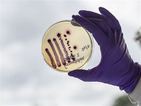 Microbiology Antech Diagnostics