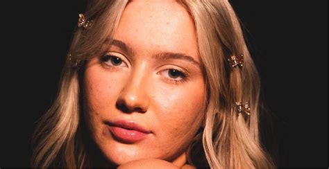 Pimple Scarring What Causes Pimple Scars And How To Prevent Them