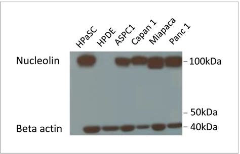 Analysis Of Nucleolin Protein Expressions In Multiple Human Pancreatic