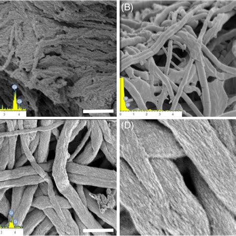Scanning Electron Micrographs Comparison Of The Microstructure Of The