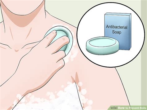 6 Ways To Prevent Boils Wikihow