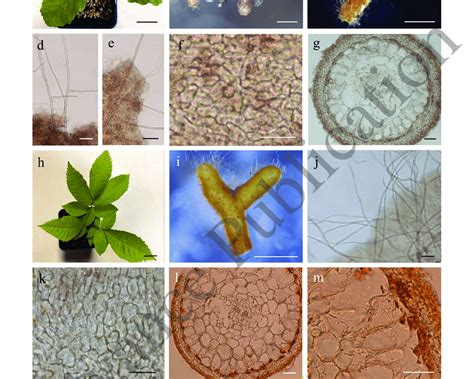 A G Ectomycorrhizal Synthesis Between Quercus Aliena And Tuber
