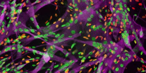 Christine Trautmann Awarded The Title Phd Laboratory Of Regenerative And Muscle Biology Eth