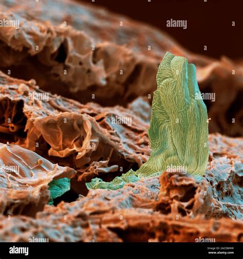 Leaf Surface Coloured Scanning Electron Micrograph Sem Of The