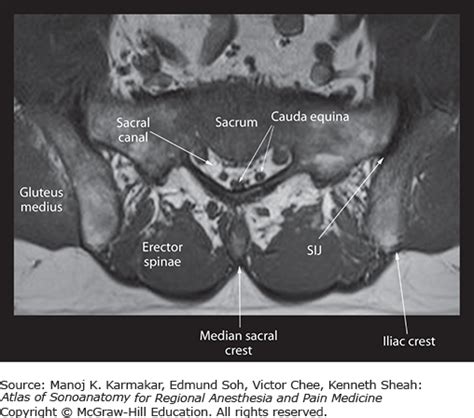 Ultrasound Imaging Of Sacrum And Lumbosacral Junction For Central