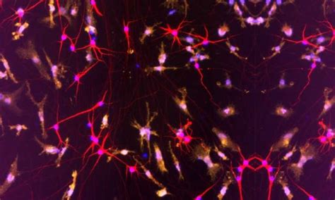 App Note Optimisation For A Live Cell In Vitro Neuronal Activity Assay