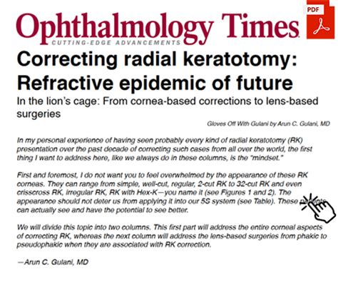 Rk Surgery Radial Keratotomy Correction Gulani Vision Institute