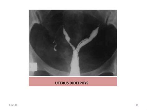 Uterine Motility Pptx Healthy Living