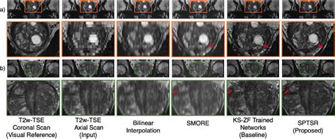 Figure From High Resolution D MRI With Deep Generative Networks Via Novel Slice Profile
