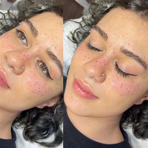 Freckle Tattoo Healing And Aftercare Ultimate Guide Artofit