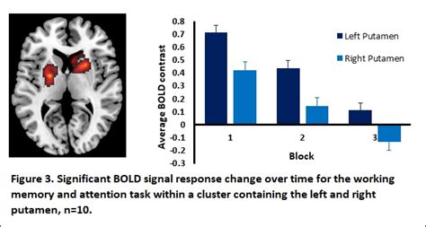 Brain Activity Patterns And Behavioural Performance In SLE Patients During A Spatial Working
