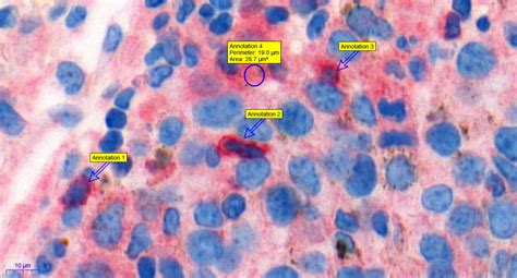 how to detect nuclei with different staining · issue 83 · qupath