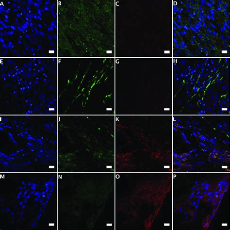Differentiation Of C2c12 Cells On Glass A B C D Pla E F G H Download Scientific