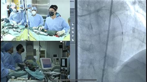 Rotablation Live In A Box Case Youtube